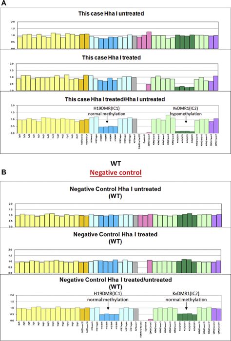 A Ms Mlpa Analysis Of Uncultured Amniocytes Using Salsa Ms Mlpa