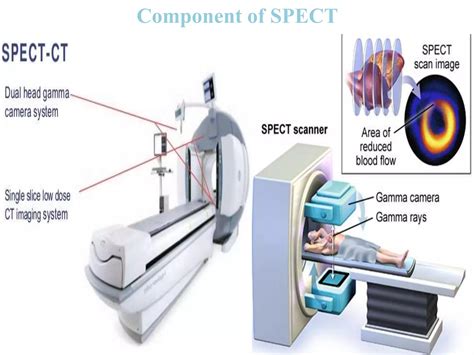 Spect With Clinical Application Pptx