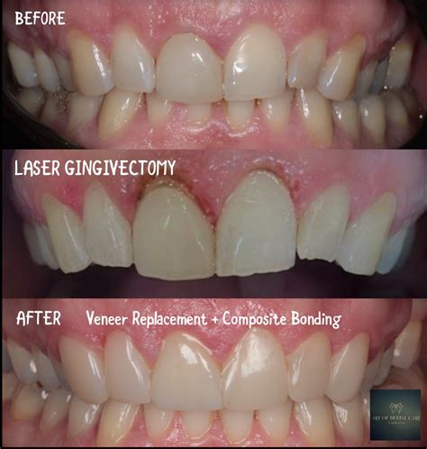 Before And After Art Of Dental Care
