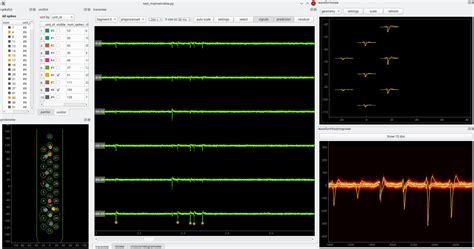 Curation Module — Spikeinterface Documentation