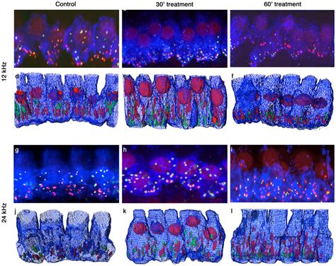 Effects Of Noise Exposure On Cochlear Inner Hair Cells As Visualized By