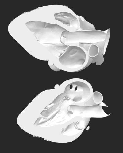 Standard Transthoracic Cardiac Echo Views Heart