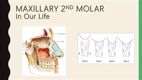 Maxillary Second Molar Pptx Maxillary Second Molar Pptx