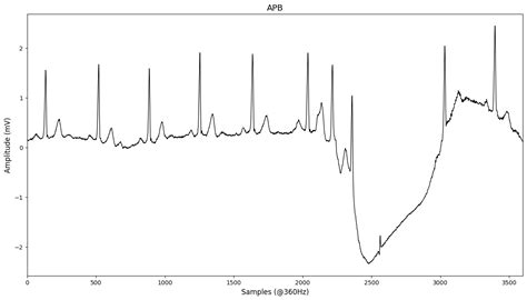 Ecgrevised Object Detection Dataset By Ecg