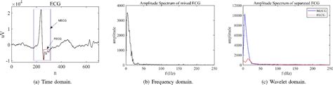 Figure 1 From Asw Net Adaptive Spectral Wavelet Network For Accurate Fetal Ecg Extraction