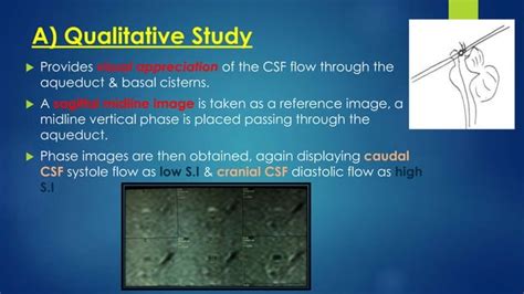 Csf Flowmetry Pptx Brain And Nervous System Disorders Diseases