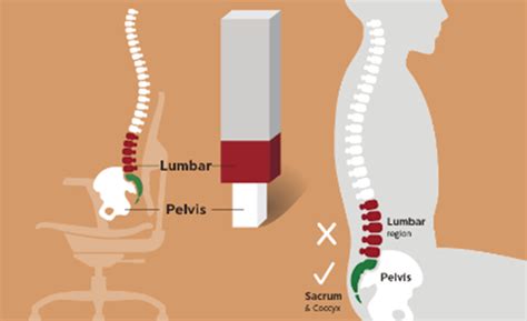 Is Your Office Chair Causing Sciatica