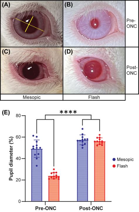 A Surgical Approach For Optic Nerve Crush In A Rabbit Model