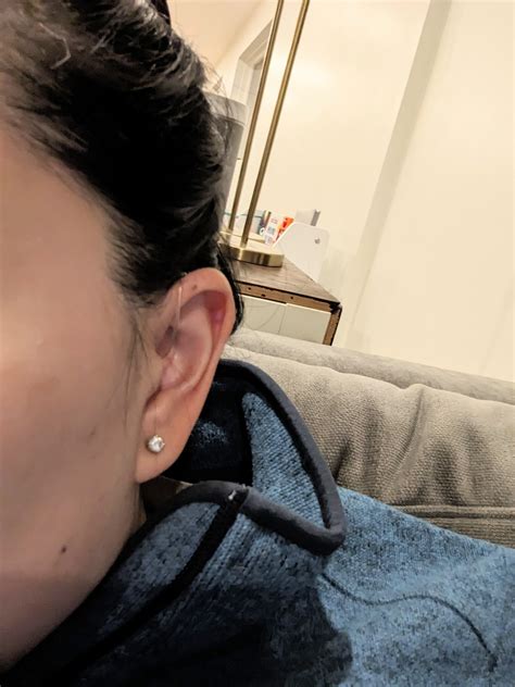 Ric Wire Not Sitting Flush Rhearingaids