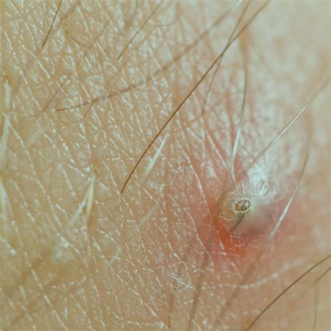 My Brazilian Wax Feel Free Feel Comfortable And Ready For Summer