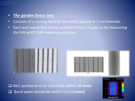 Multileaf Collimator Pptx