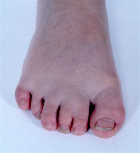 Defining Morphology Hands And Feet Pmc