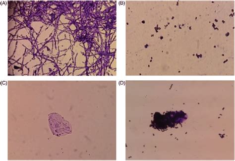 Photomicrography Of Trichoderma Adhering To Crop Epithelial Cells Of