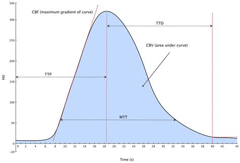 Interpreting Ct Perfusion In Stroke Practical Neurology