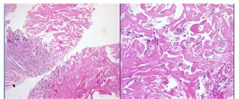 Microscopic View Of Lesion Download Scientific Diagram