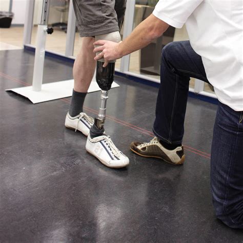 Guidance On Selecting The Right Prosthetist