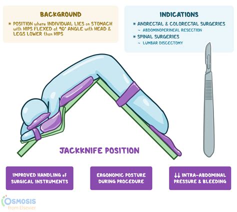 Jackknife Position What Is It Uses And More Osmosis