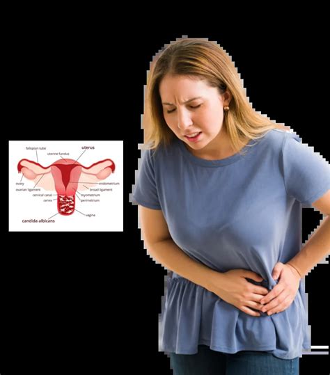 Yeast Infection Treatment For Women