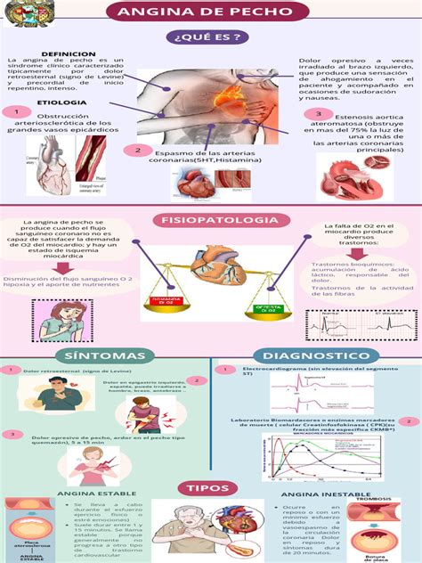Infografia Final Angina De Pecho Pdf Corazón Fisiología