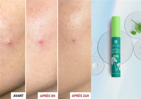 Nos Soins Centella Acne Erborian Fr