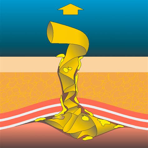 How A Penrose Drain Works At Randy Llamas Blog