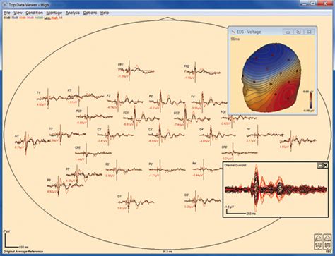 Besa® Brain Electrical Source Analysis Features Erp Analysis And Averaging