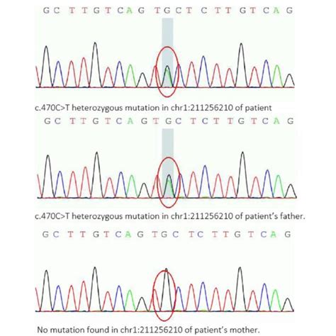 Pyrosequencing Profiles Of Three Genotypes Of The C470c T