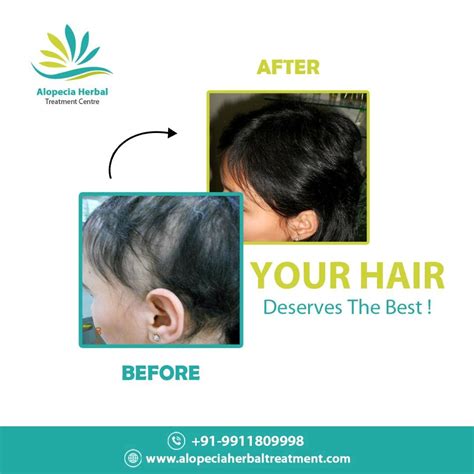 Drvivek Giri Posted On Linkedin