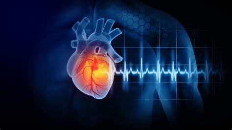 Abbott Gets Ce Mark For Dual Chamber Leadless Pacemaker System