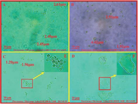 Microalgae Cell Morphology Was Imaged By Bright Field Fluorescence