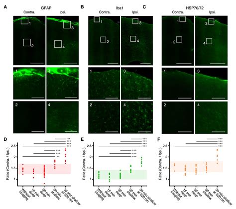 Two-photon calcium imaging of the medial prefrontal cortex and hippocampus without cortical ...