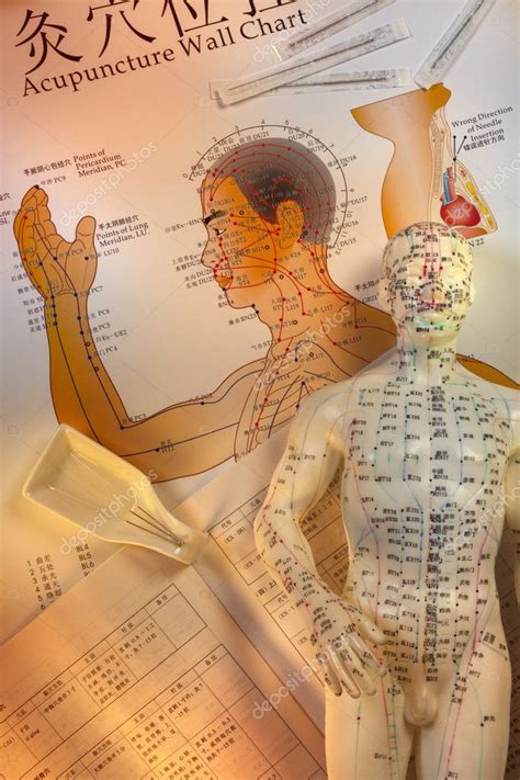 Traditional Chinese Acupuncture Stock Editorial Photo © Steve Allen