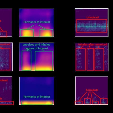 Activation Map Visualization For Model Interpretation Download