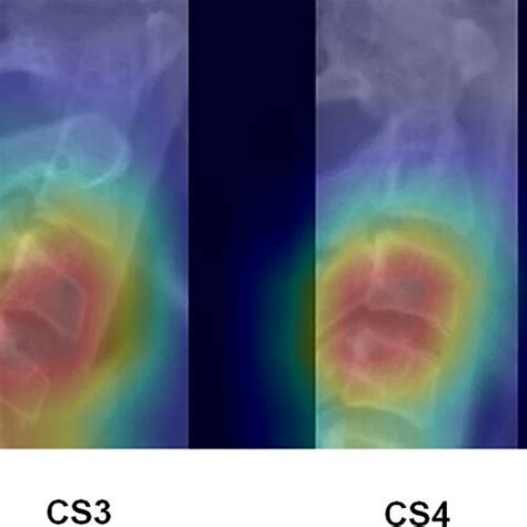 Representative Class Activation Map Of The Correct Classification In Download Scientific