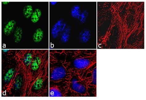 Kmt2d Antibody 701869