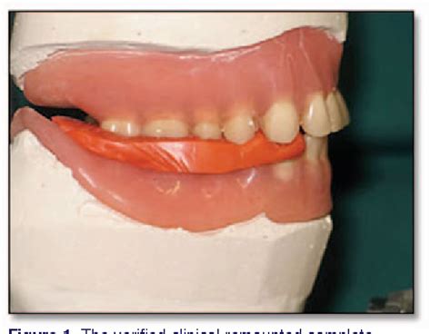 Occlusal Surface Layer Of Right First Upper Premolar Tooth Semantic