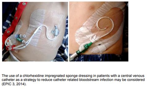 How To Draw Blood Cultures From Picc Line