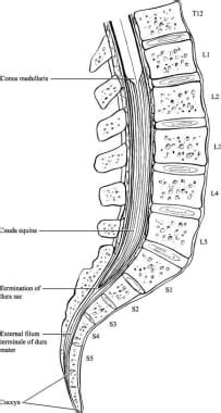 Spinal Cord Cauda Equina Conus Medullaris