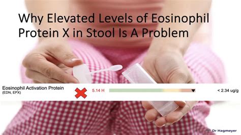 Eosinophil Protein X In Stool Why Your Levels Are Elevated Dr Hagmeyer