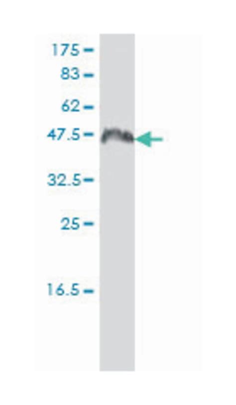 Anti Ccnk Antibody 200ul
