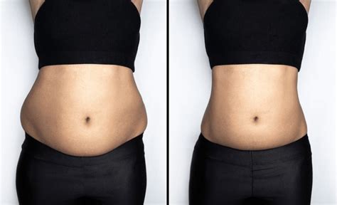 2 Thousand Before After Body Woman Asian Royalty Free Images Stock