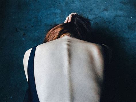 Hyperkyphosis Signs Causes Diagnosis And Treatment