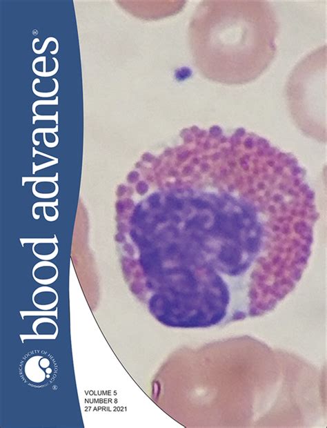 Clinical Molecular And Prognostic Comparisons Between Ccus And Lower