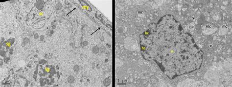 Electron Micrograph Tem Of Rat Testes From Group E Cryopreserved