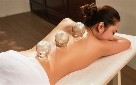 What Is Cupping Therapy What To Expect Benefits Drawbacks