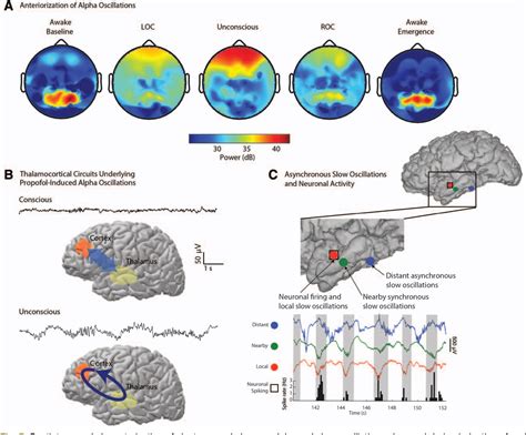 Electroencephalography Pronunciation