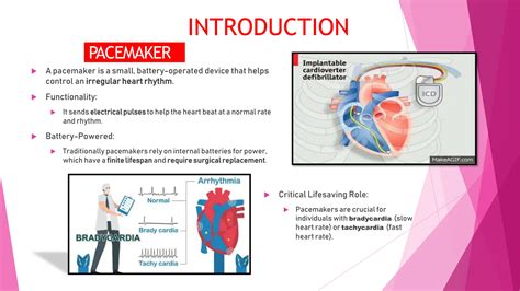 Wireless Charger For Implantable Pacemakerspptx