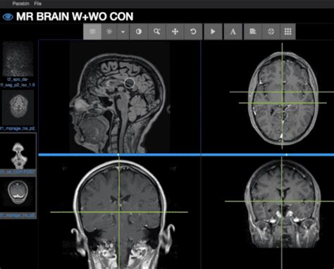 Best DICOM Viewers For Windows MacOS Web Mobile