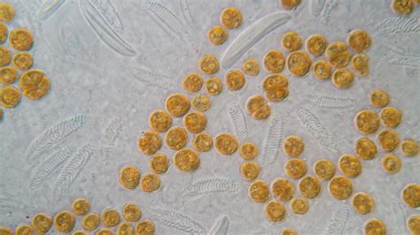 Symbiodiniaceae Osu Weis Lab Flickr