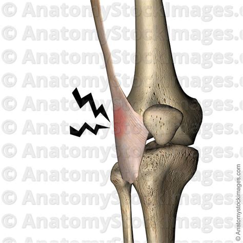 Anatomy Stock Images Knee Tractus Iliotibialis Iliotibial Band